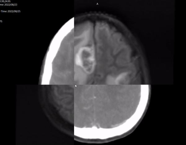 An easier way to realize MR Sim with CT facilitie